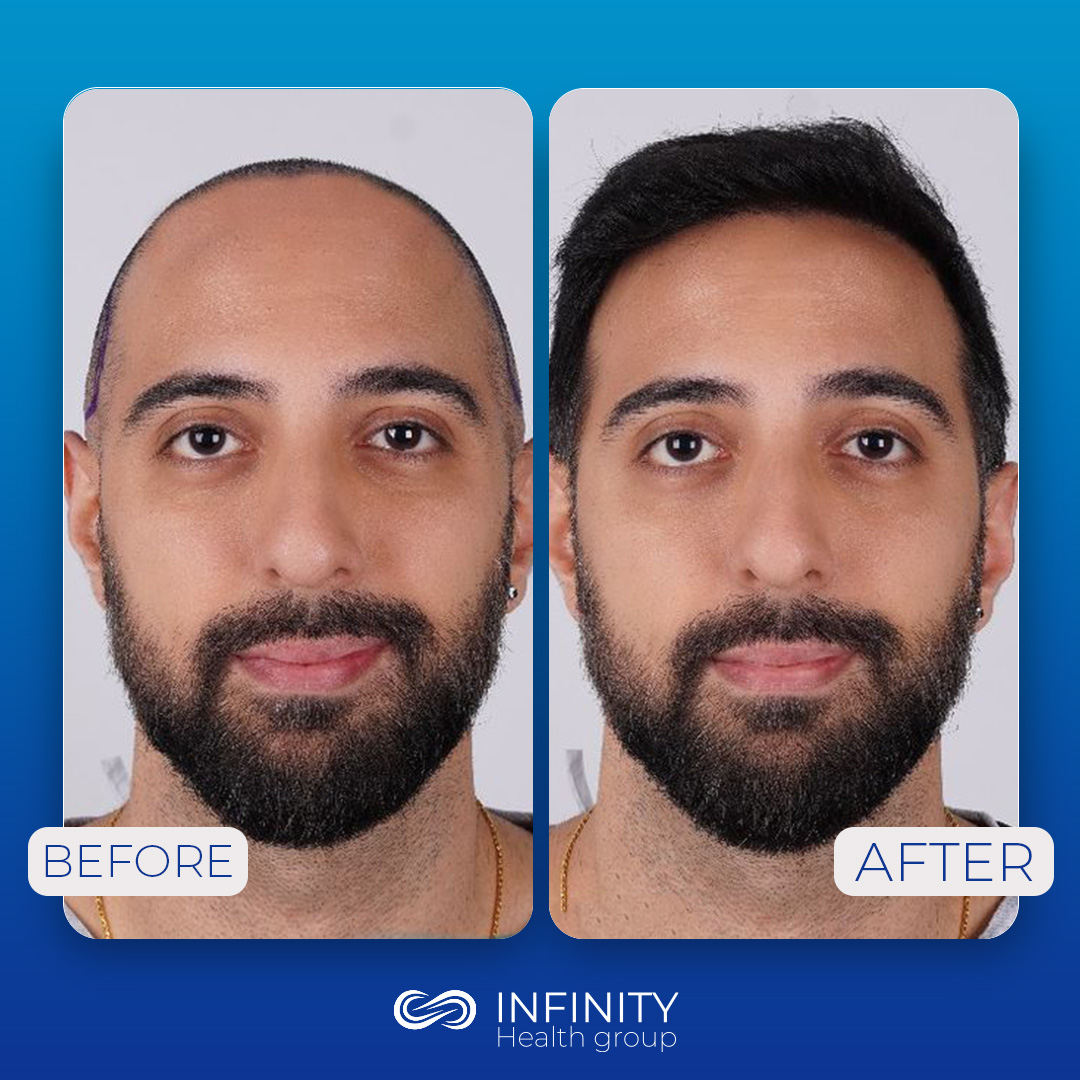 Infinity Health Group