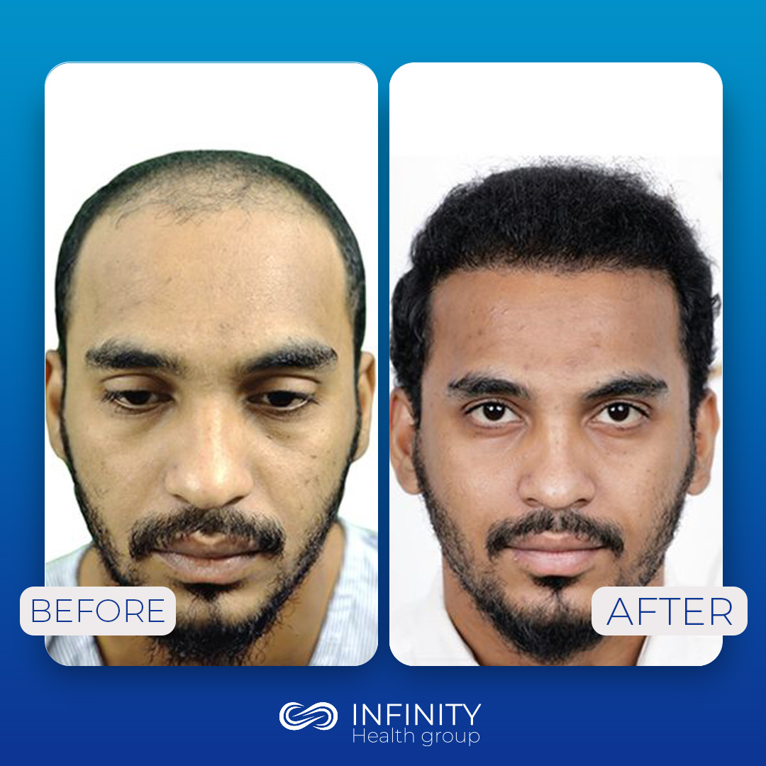 Infinity Health Group